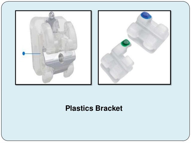 Orthodontic Bracket Materials