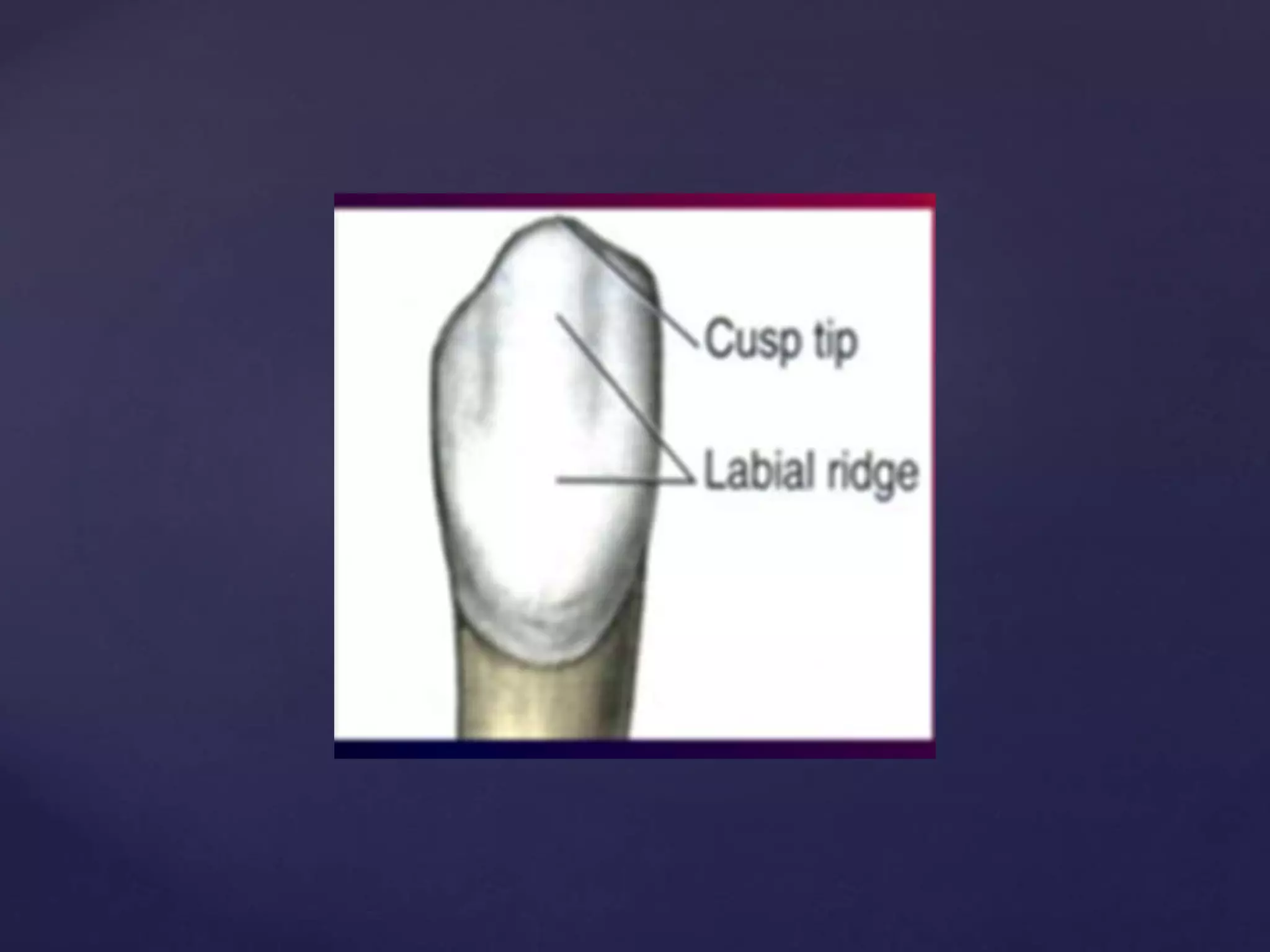 placement of orthodontic brackets | PPTX