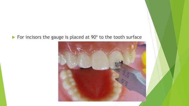 bracket positioning in orthodontics.pptx
