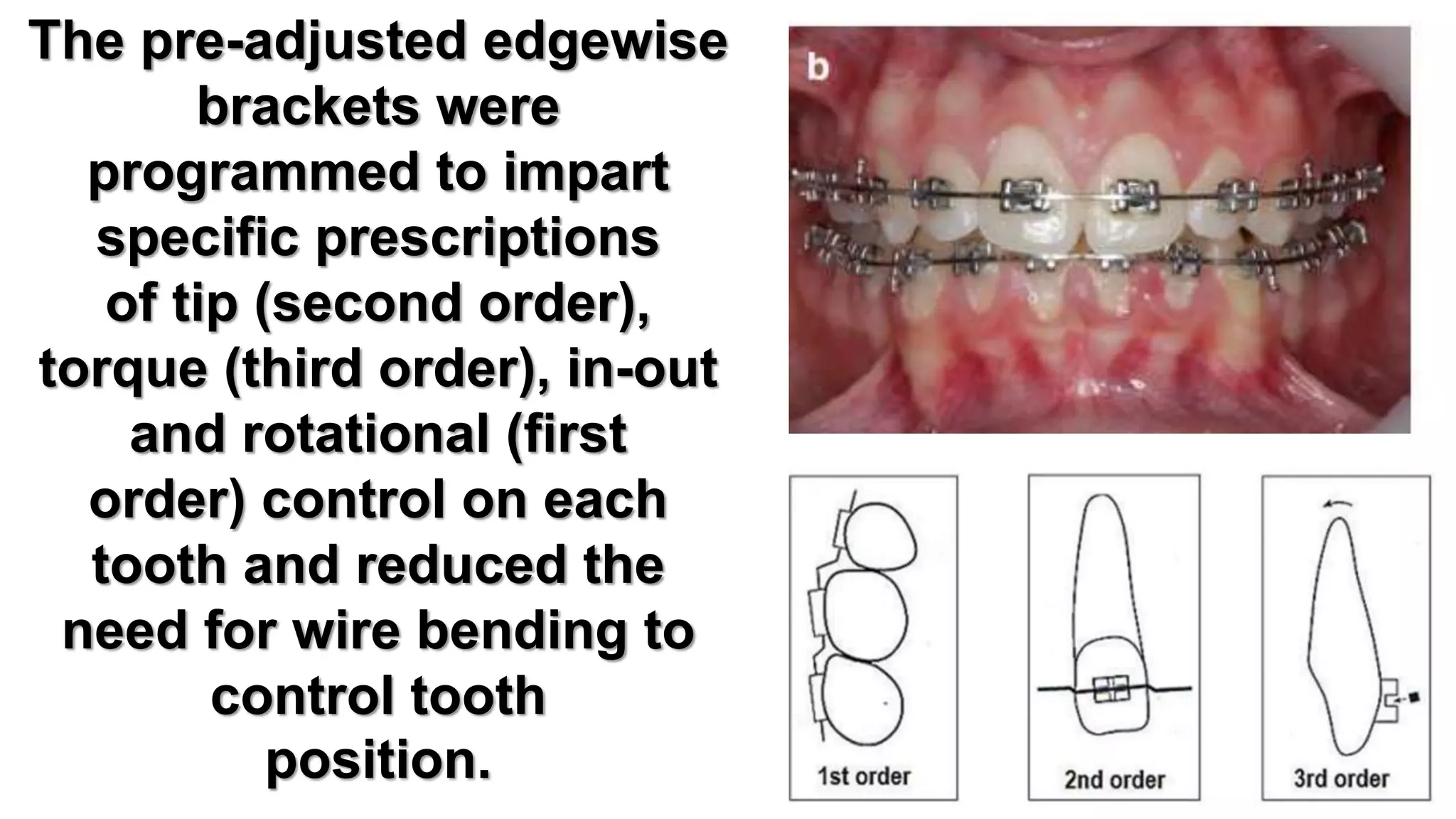 orthodontic bracket prescription 1 | PPTX