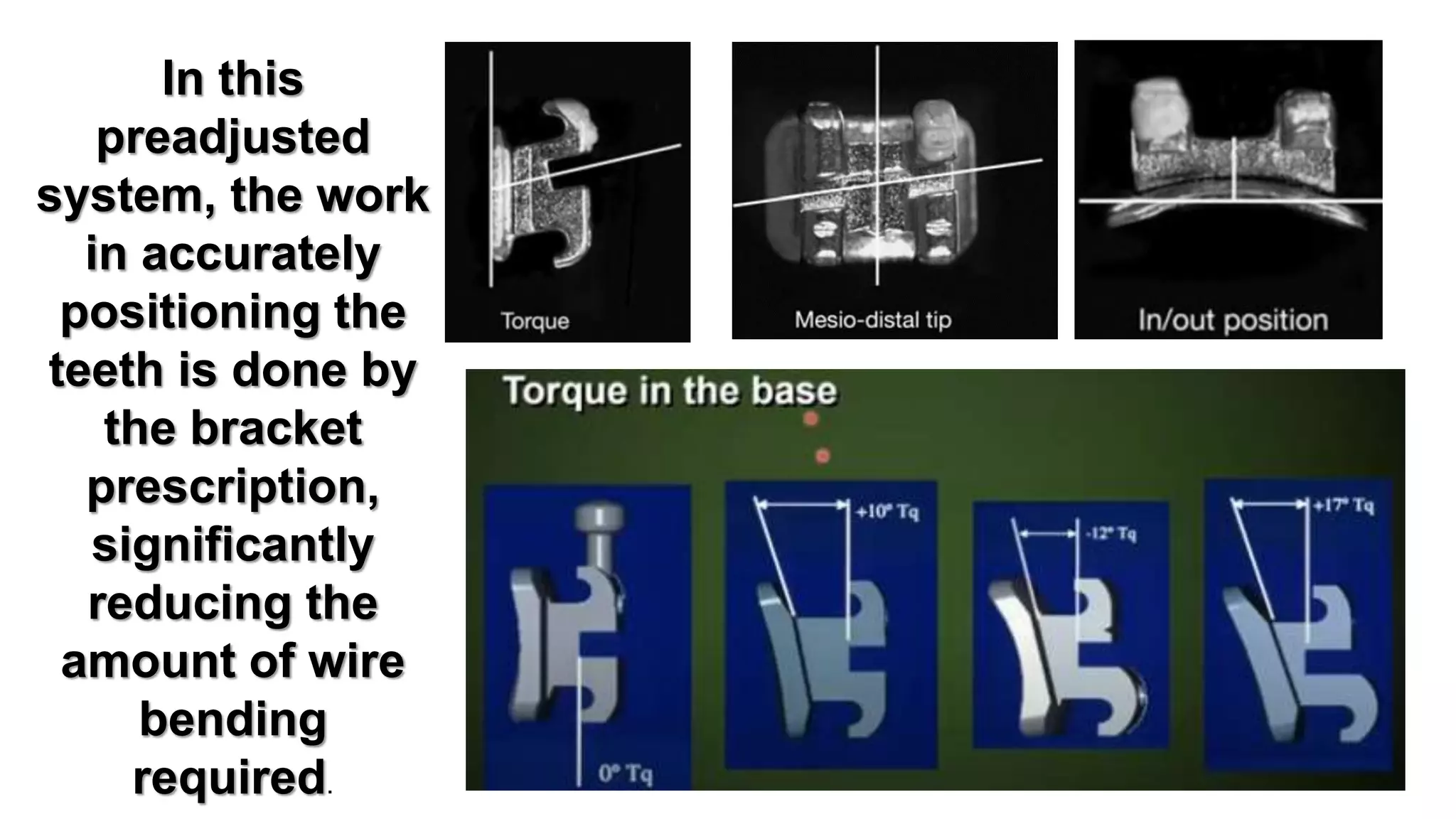 orthodontic bracket prescription 1 | PPTX