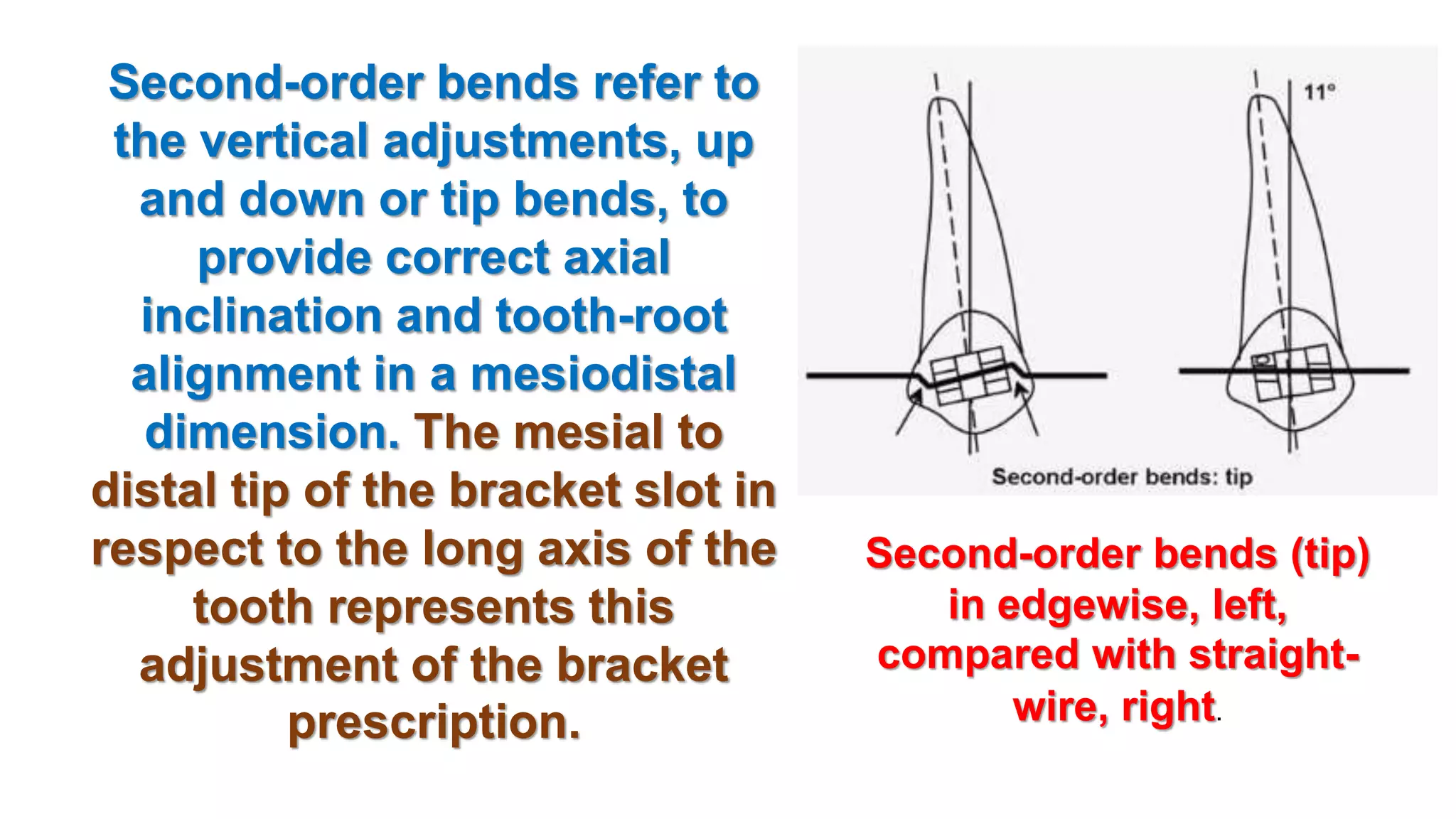 orthodontic bracket prescription 1 | PPTX