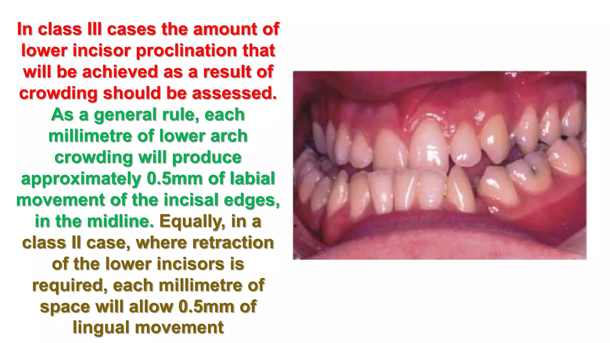 orthodontic bracket prescription 1 | PPTX