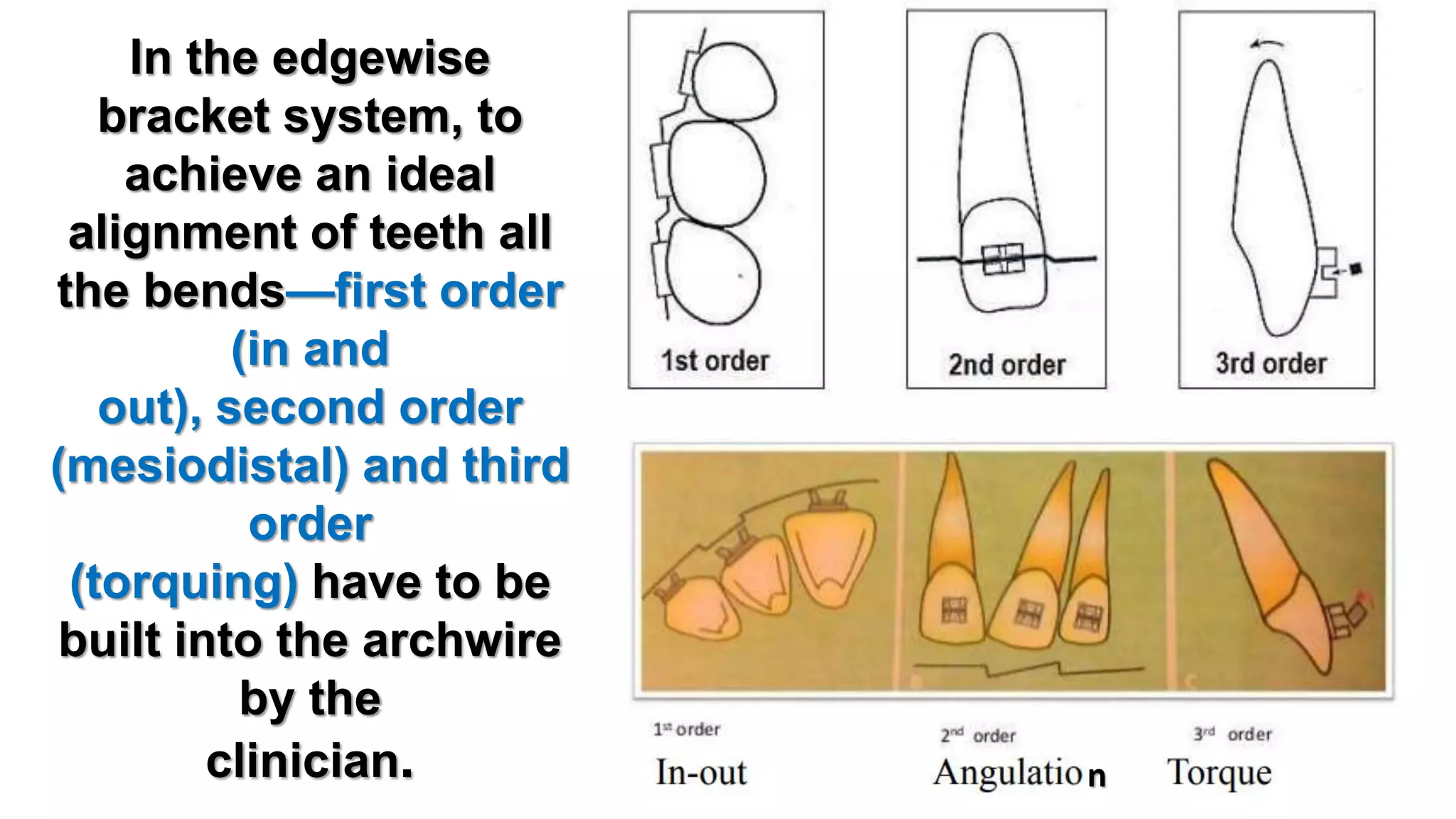 orthodontic bracket prescription 1 | PPTX