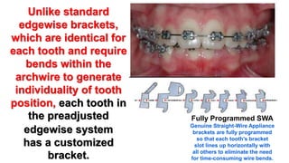 orthodontic bracket prescription 1 | PPTX