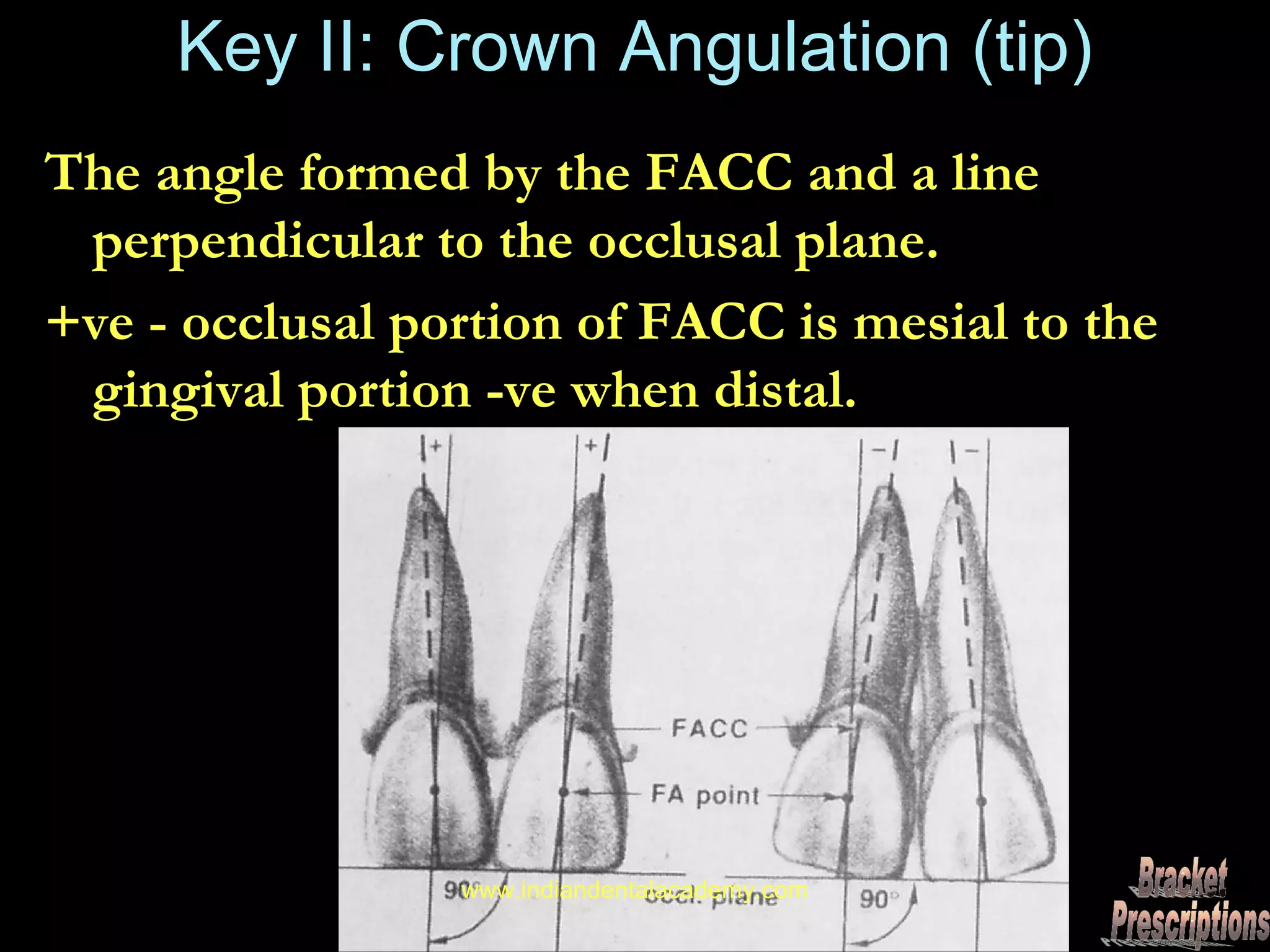 Bracket prescriptions part 1 | PPT