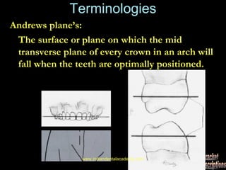 Bracket prescriptions part 1 | PPT
