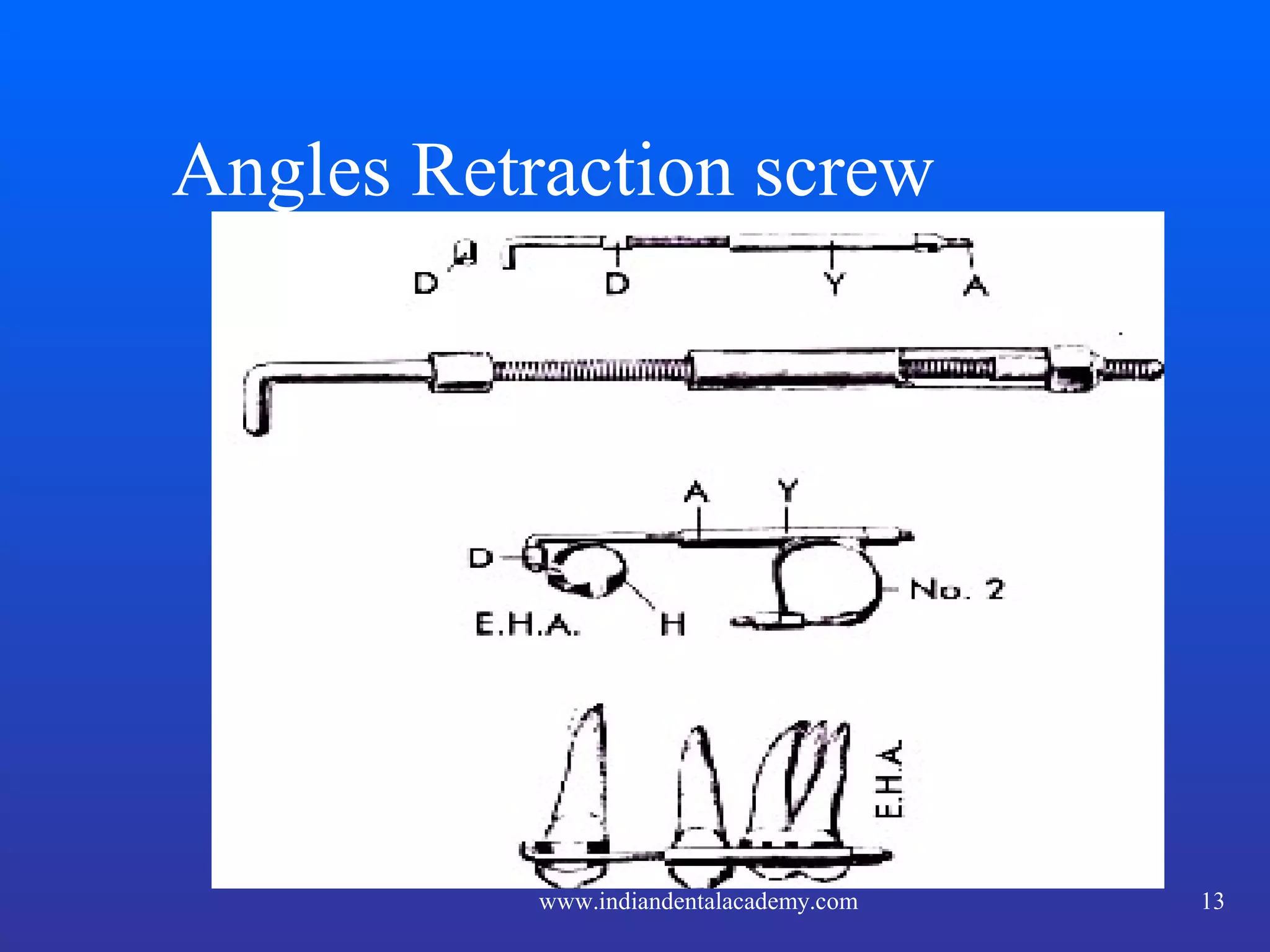Brackets in orthodontics | PPT