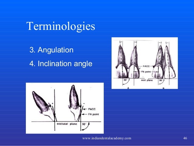 Brackets in orthodontics