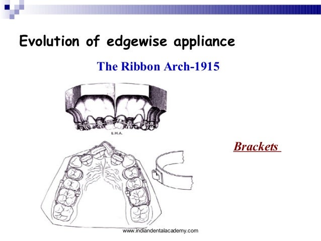 Brackets in orthodontics /certified fixed orthodontic courses by Indi…