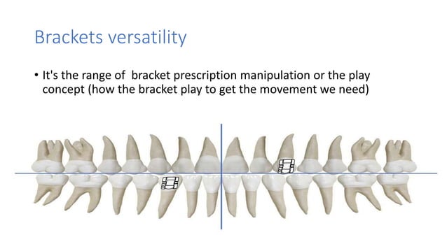 Brackets _versatility _ final (new).pptx | Dental Health | Diseases and ...