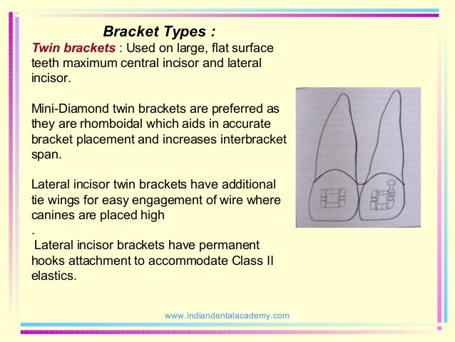 Bracket system 1