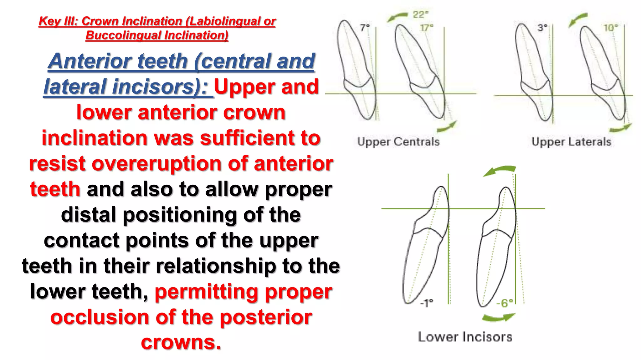 orthodontic Bracket variations | PPTX