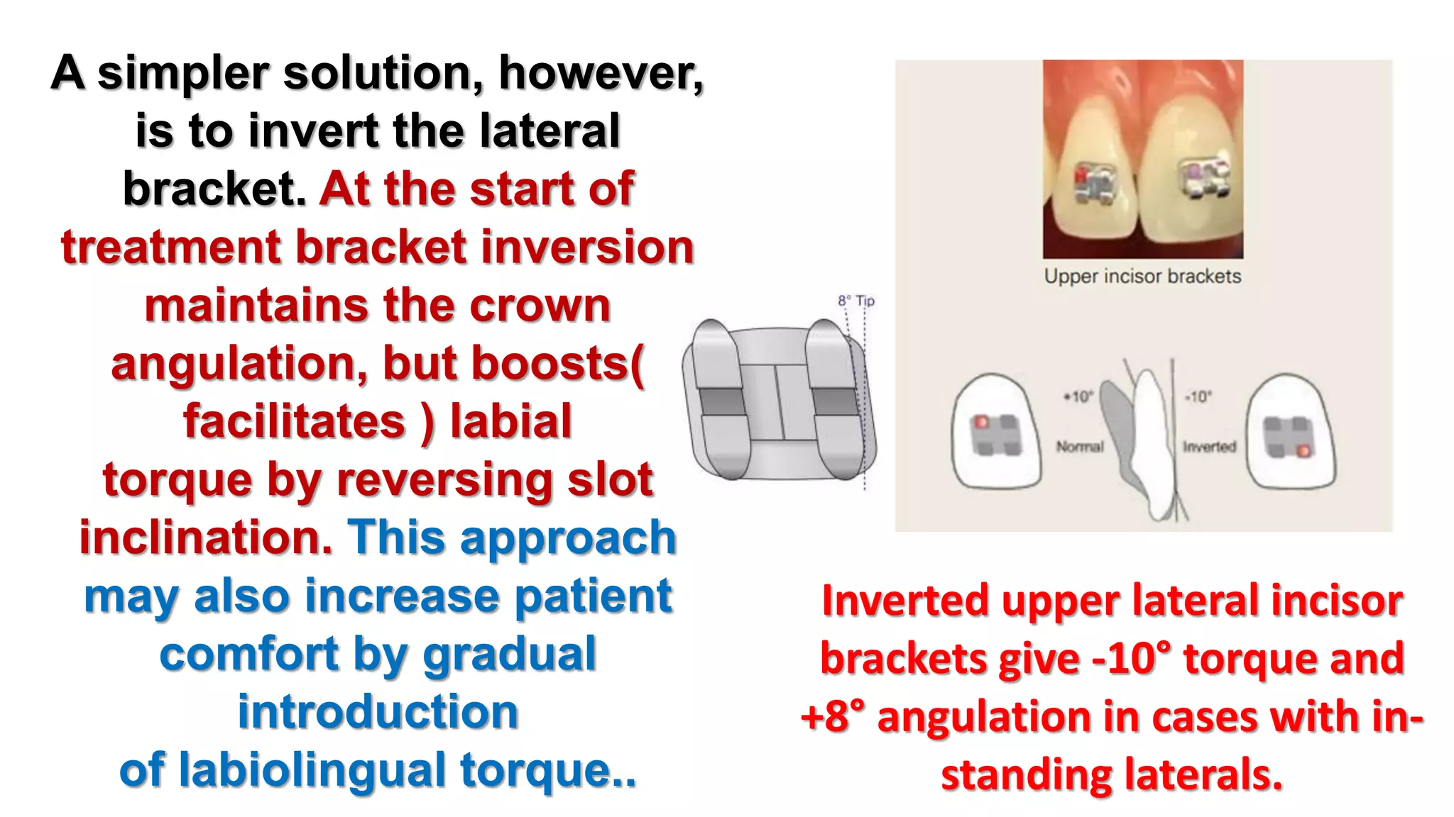 orthodontic Bracket variations | PPTX