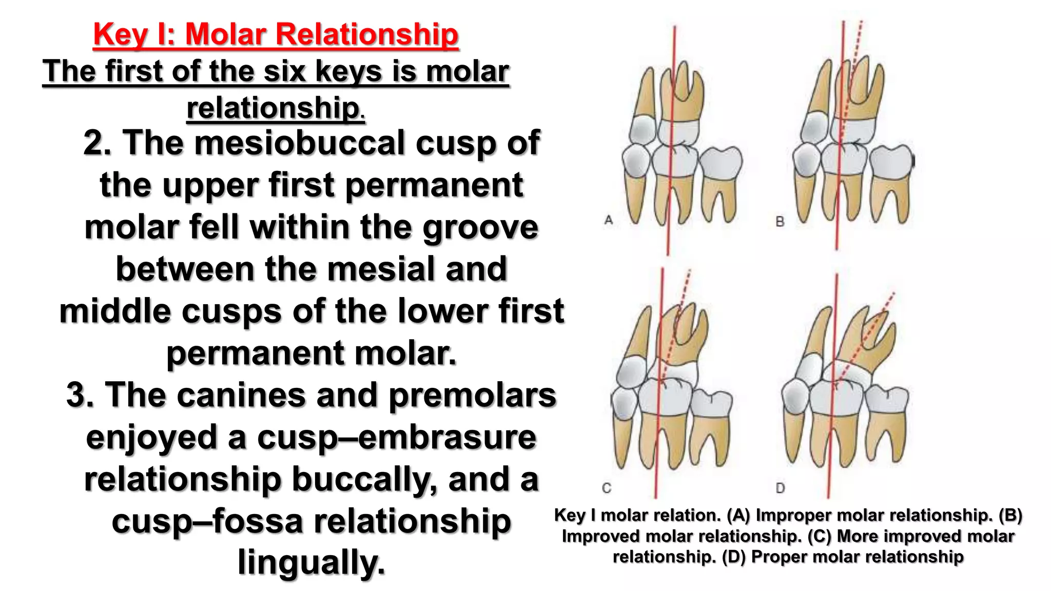 orthodontic Bracket variations | PPTX