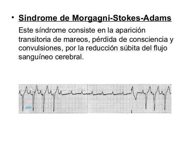 EXCITACIÓN RITMICA DEL CORAZÓN – Brenda Alejandra