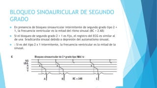BRADICARDIA SINUSAL Y BLOQUEO SINOAURICULAR.pptx