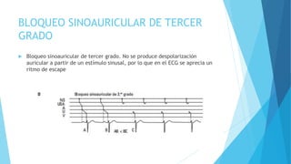 BRADICARDIA SINUSAL Y BLOQUEO SINOAURICULAR.pptx