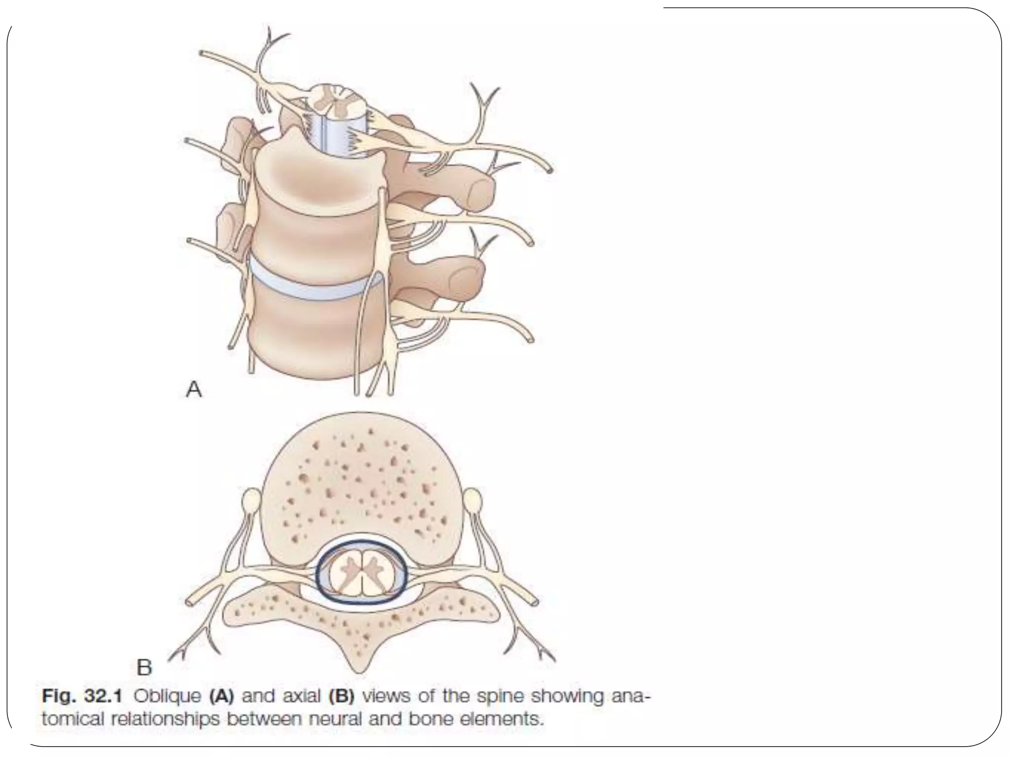 lower back and leg pain approaches | PPTX