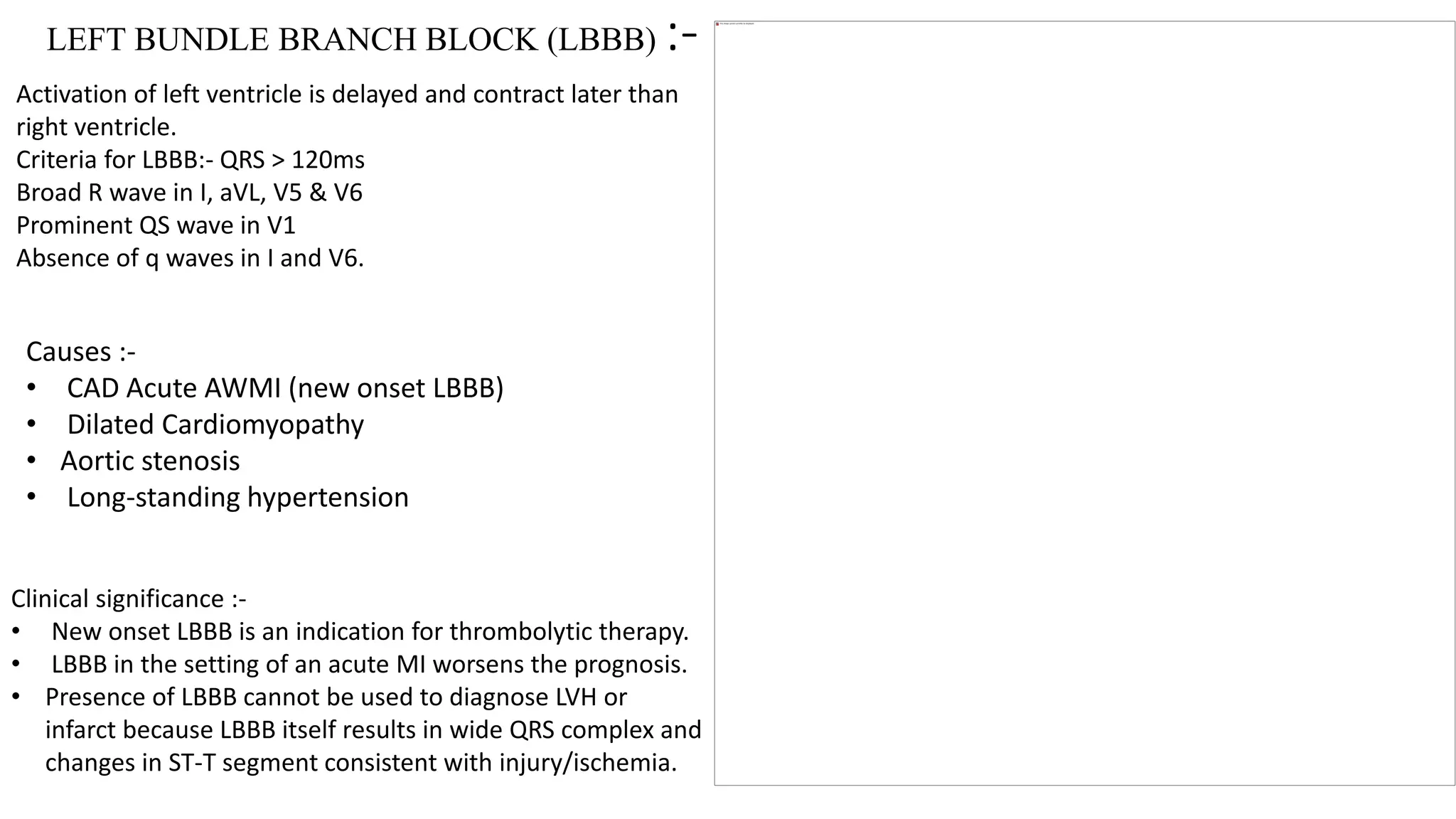 BRADYARRHYTHMIAS; Disorders of SA node , AV node and Intraventricular ...