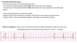 BRADYARRHYTHMIAS; Disorders of SA node , AV node and Intraventricular ...