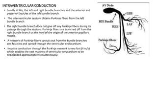 BRADYARRHYTHMIAS; Disorders of SA node , AV node and Intraventricular ...