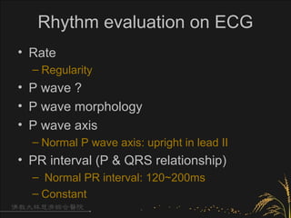 Arrhythmia :ECG-Bradycardia_20120909_中區 | PPT