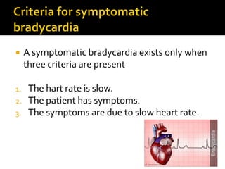 Bradycardia | PPTX