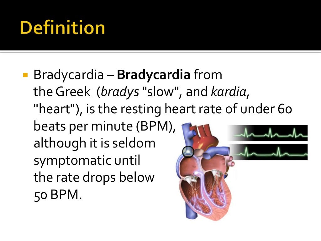 Bradycardia