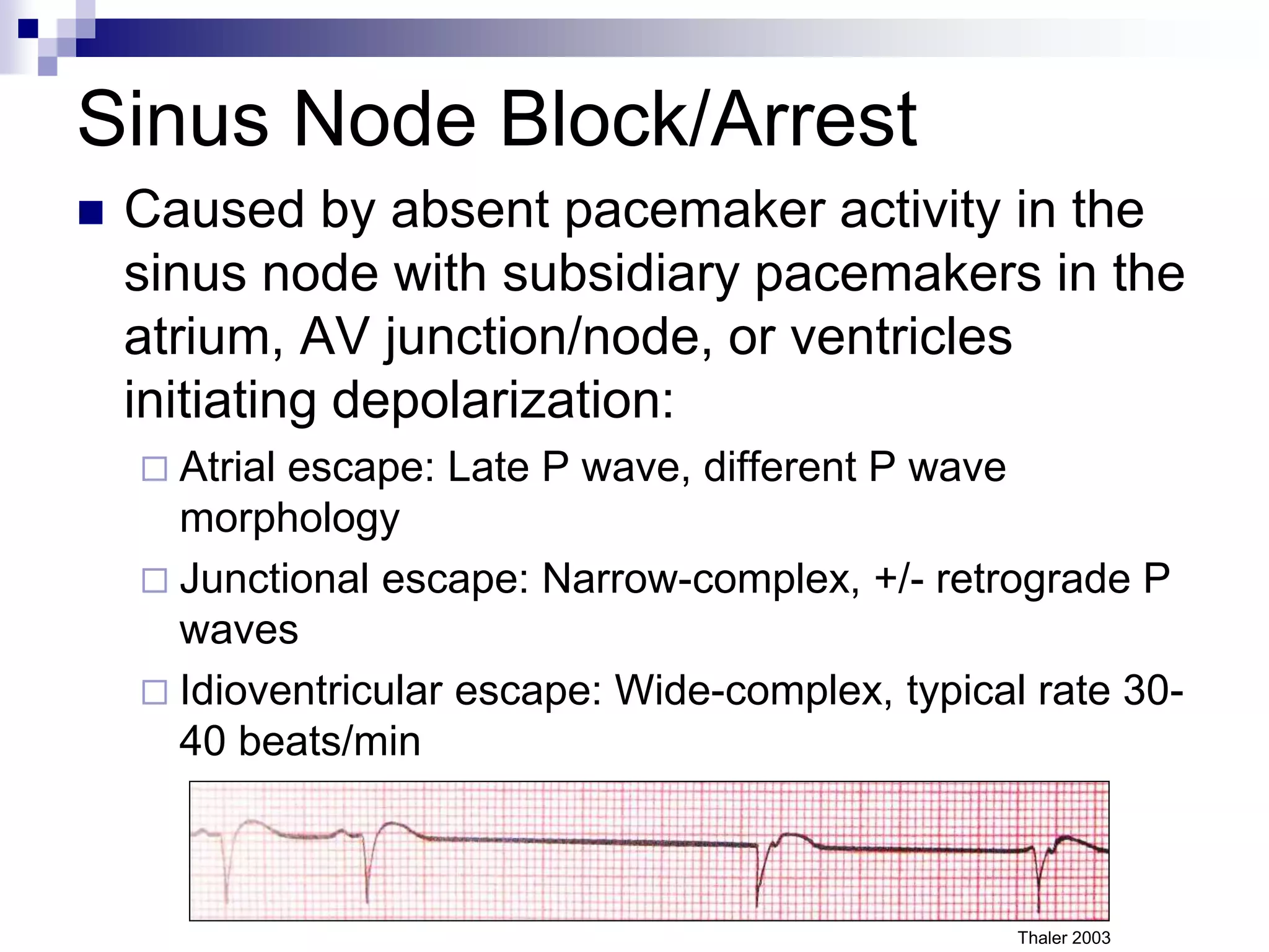 Bradycardia_-_Presentation (1).pdf