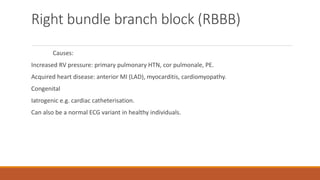 Bradycardias and conduction defects | PPT