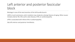 Bradycardias and conduction defects | PPT