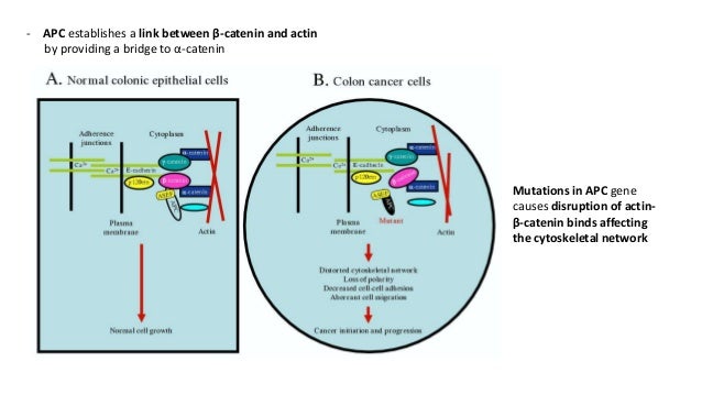 Braf lynch syndrome mmr right and left colon cancer