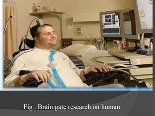 Brain gate technology(AI) | PPT