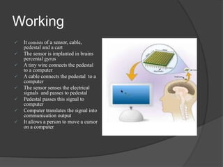 Brain gate technology(AI) | PPT