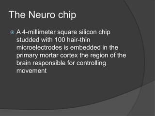 Brain gate technology(AI) | PPT