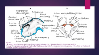 Brain- THE ORIGIN..ANATOMY | PDF
