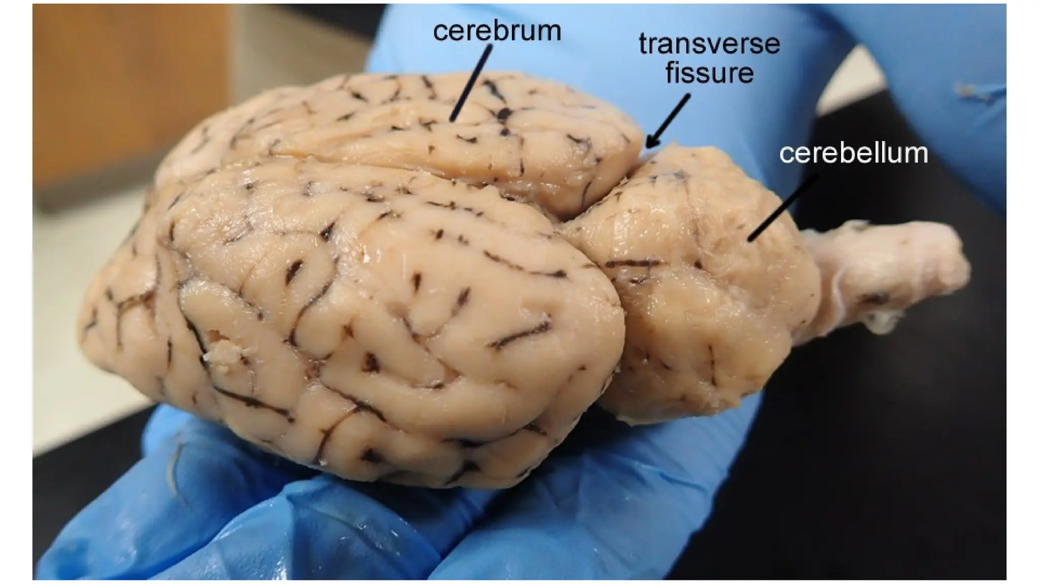 Human BRAIN (anatomy and Physiology) .pptx