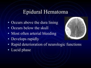 Brain And Craniofacial Trauma Brenda | PPT