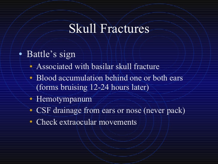 Brain And Craniofacial Trauma Brenda