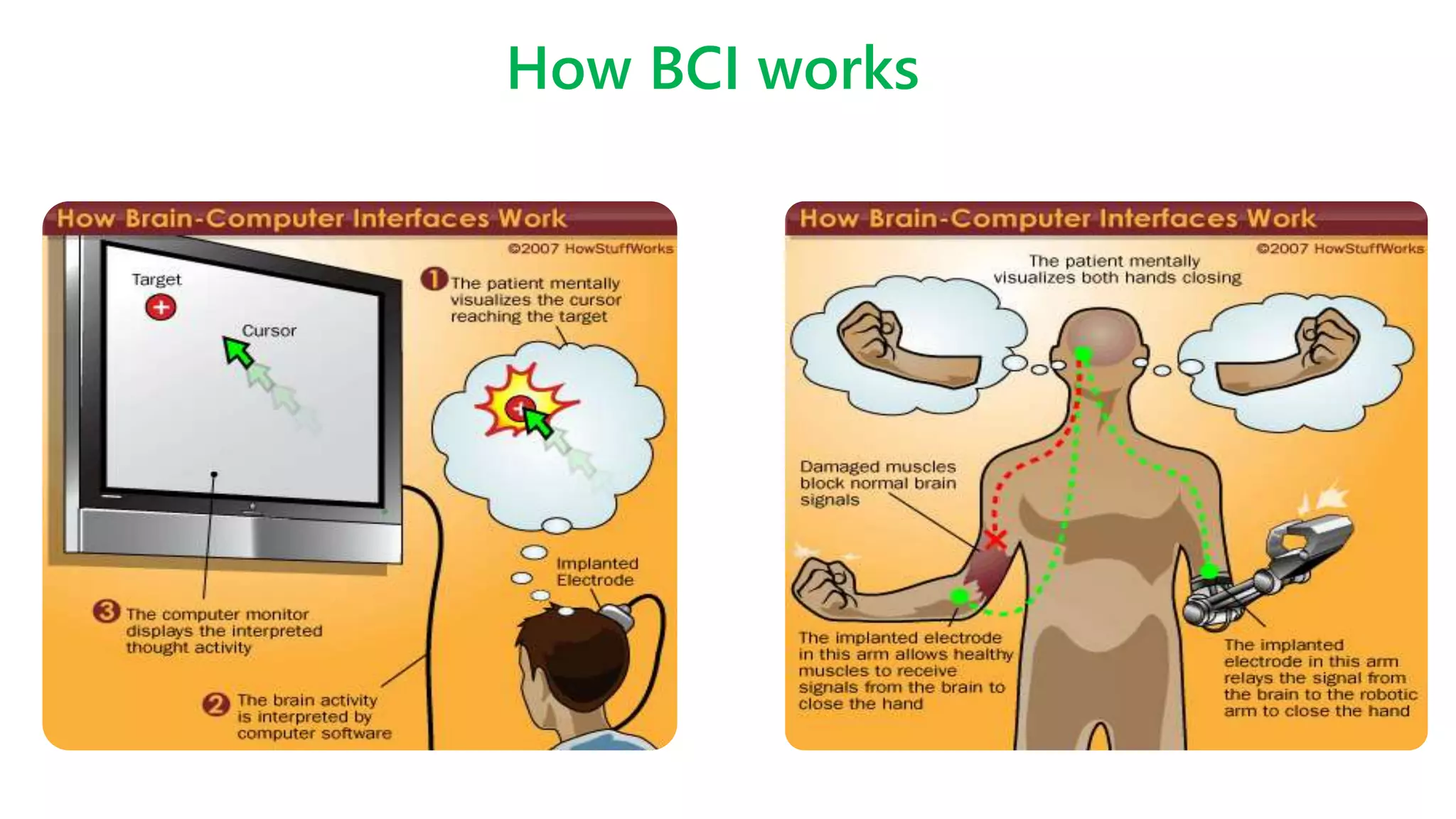 Brain Computer Interface (BCI) | PPTX