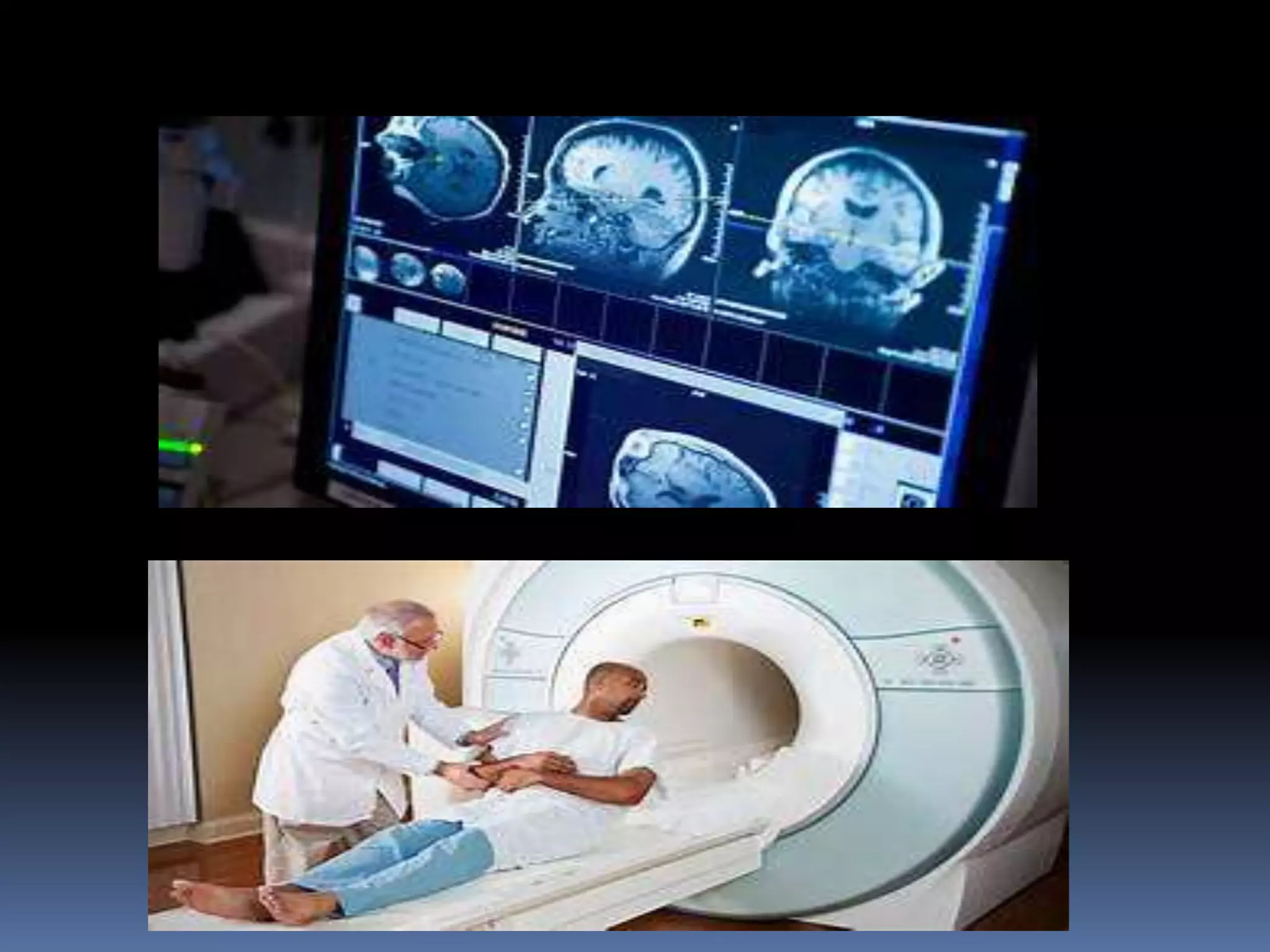 Brain Mapping Techniques | PPTX