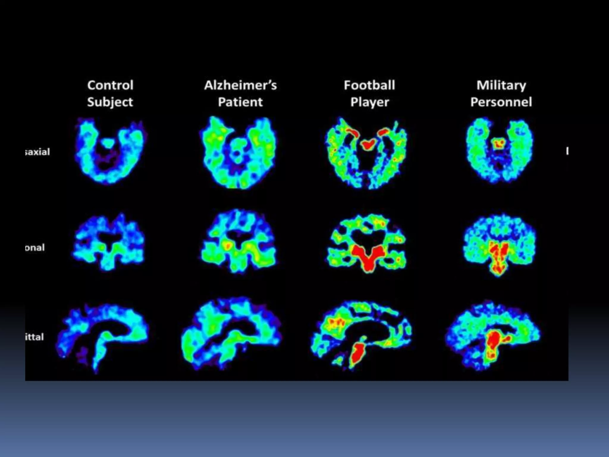 Brain Mapping Techniques | PPTX
