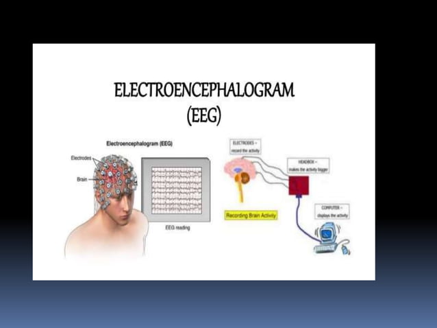 Brain Mapping Techniques | PPTX