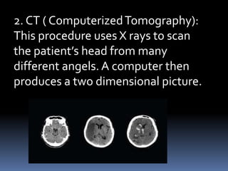 Brain Mapping Techniques | PPTX