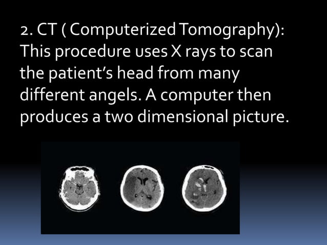 Brain Mapping Techniques | PPTX