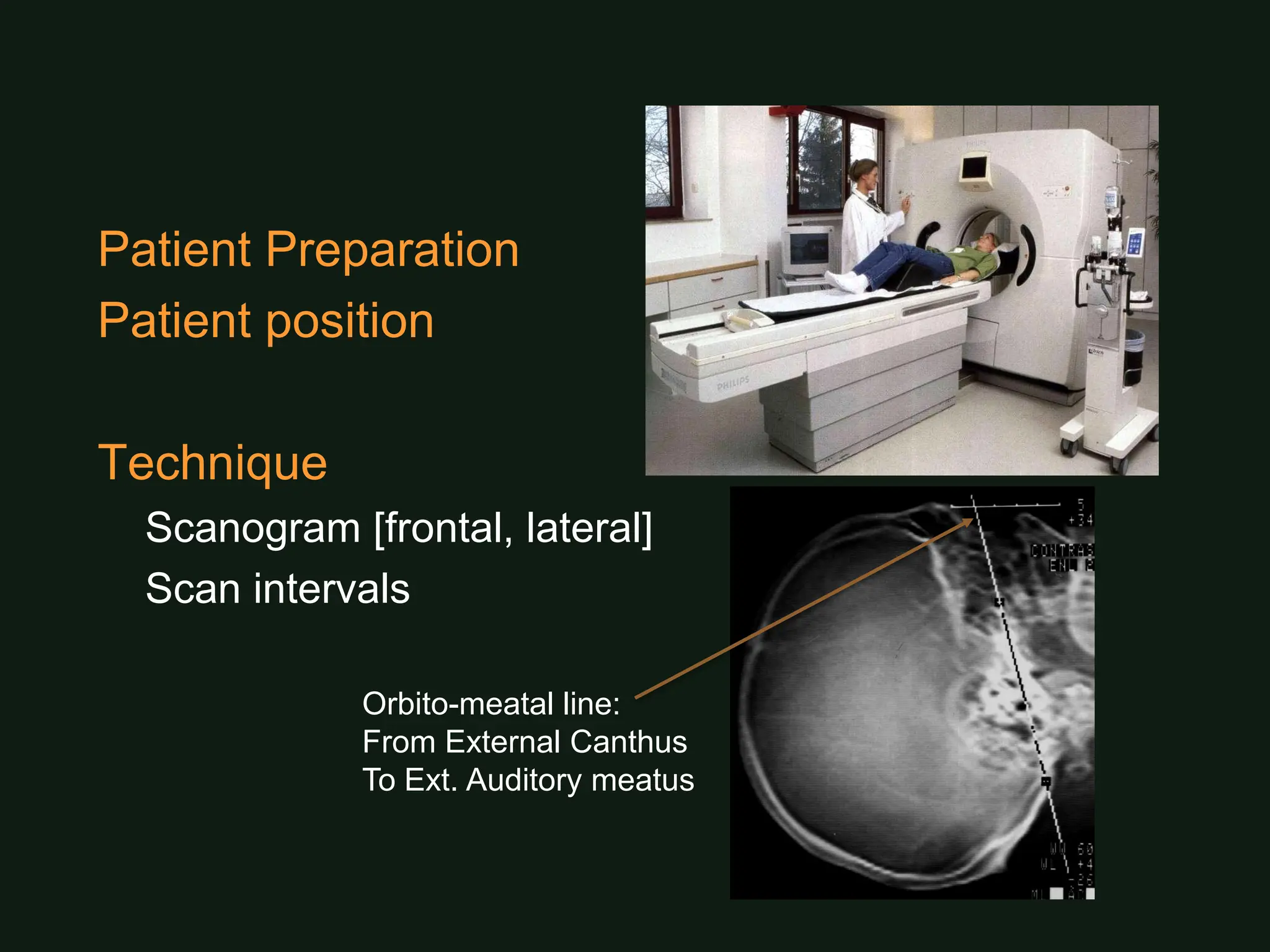 Normal brain imaging in CT and MRI for medical students | PDF