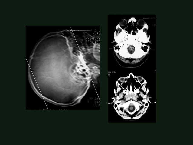 Normal brain imaging in CT and MRI for medical students | PDF | Brain ...