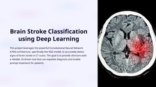 BRAIN-STROKE-IMAGE-CLASSIFICATION using neuro images | PPTX