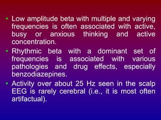 AI on brain - waves activity ppt4916.ppt